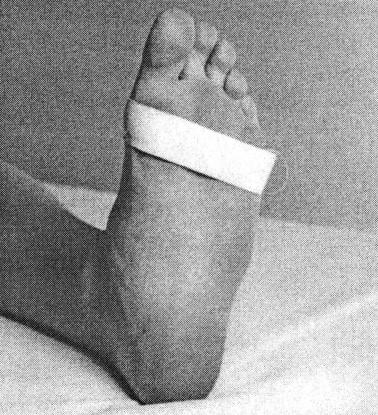 Tejpování - Noha (chodidlo), Prsty nohy :: TJ Nesovice